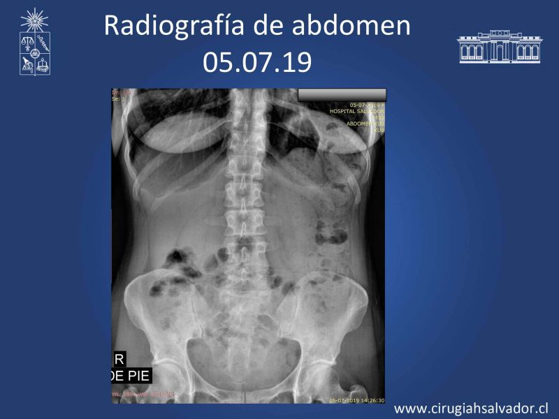 Presentaciones - Depto. Cirugía Hospital del Salvador